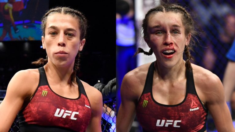 IMAGEM FORTE! Joanna Jedrzejczyk fica com rosto deformado após batalha ...