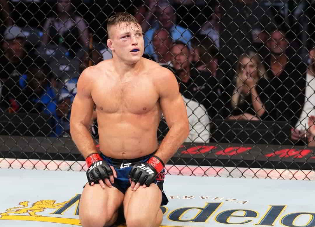 IMAGEM FORTE: Rival De Jean Silva Fica Com O Rosto Deformado Após ...