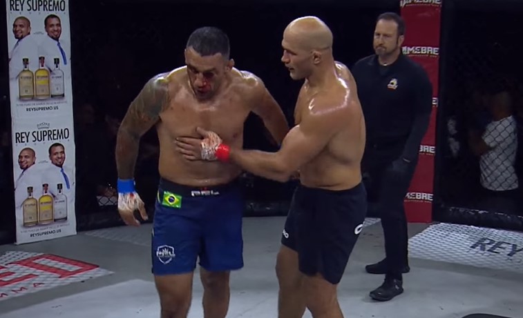IMAGEM FORTE: Vítima de Cigano, Werdum deixa luta com rosto desfigurado ...