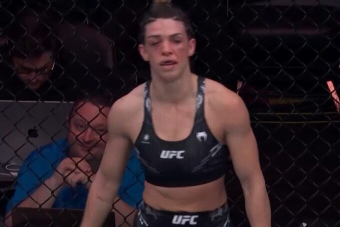 IMAGEM FORTE: Veja o rosto de Mackenzie Dern após batalha contra Amanda ...
