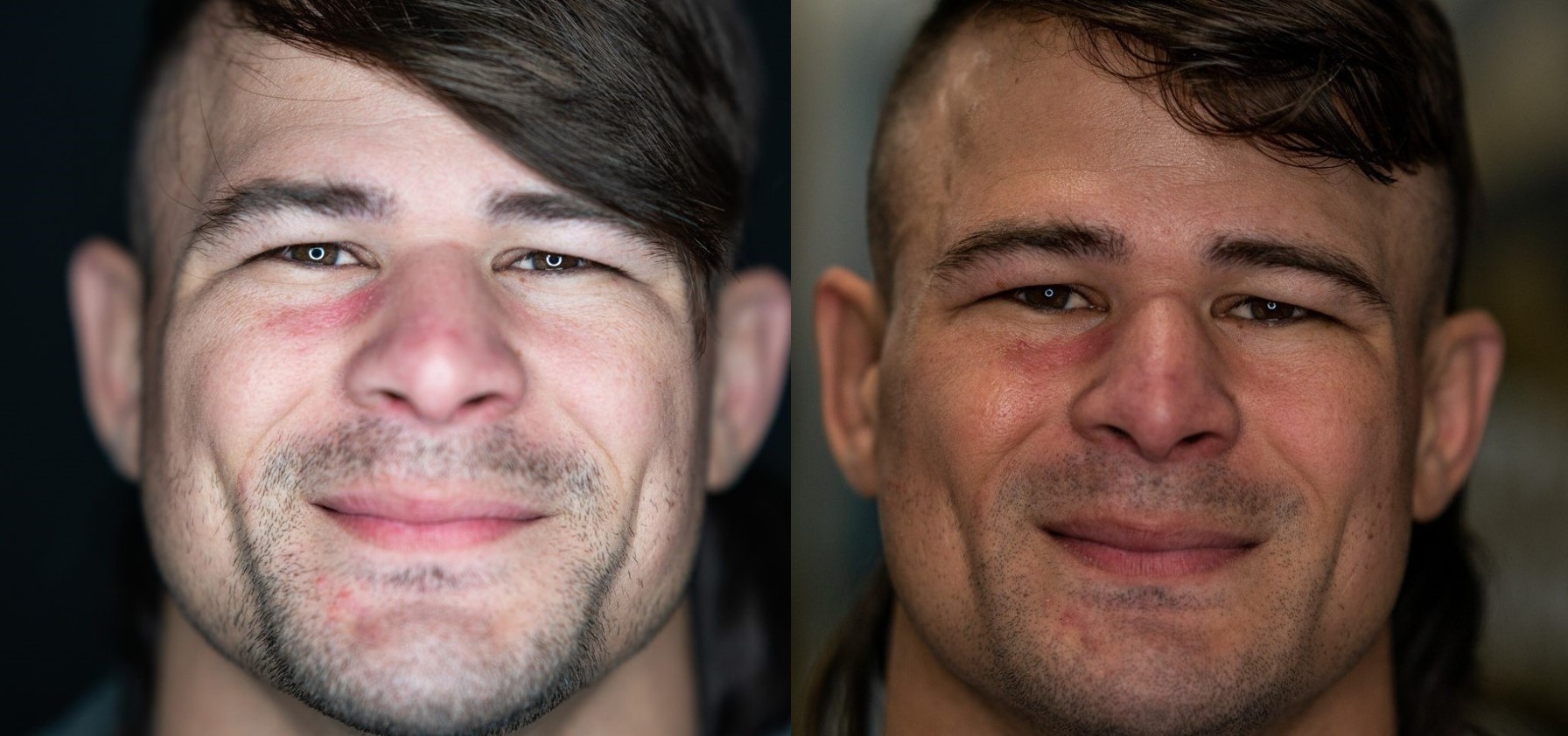 Marcas da batalha: confira como ficou o rosto de Poatan e outras ...