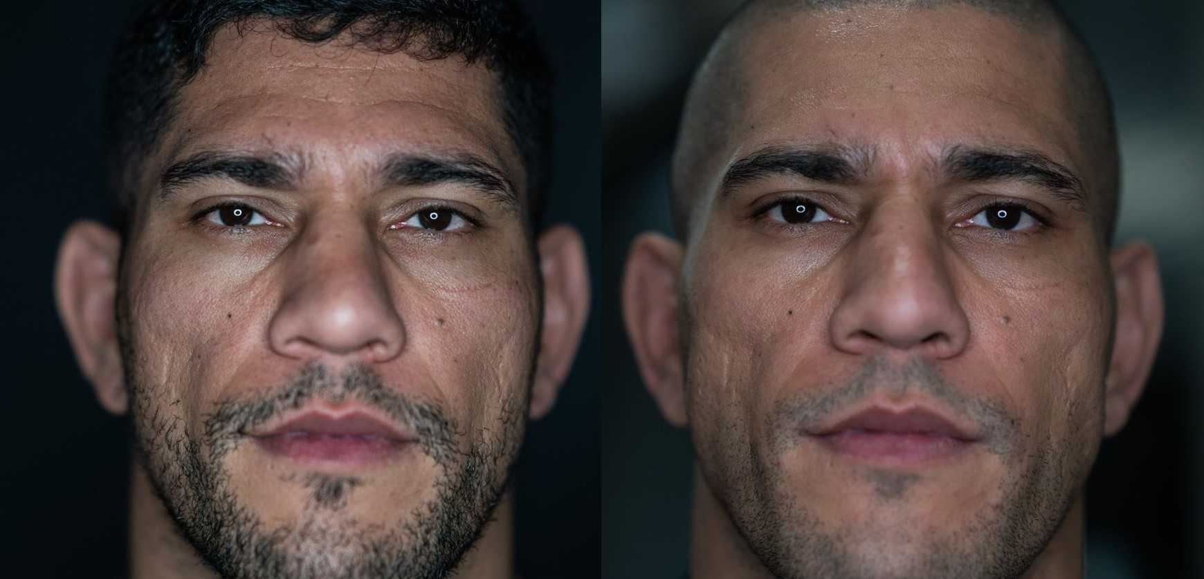 Marcas da batalha: confira como ficou o rosto de Poatan e outras ...