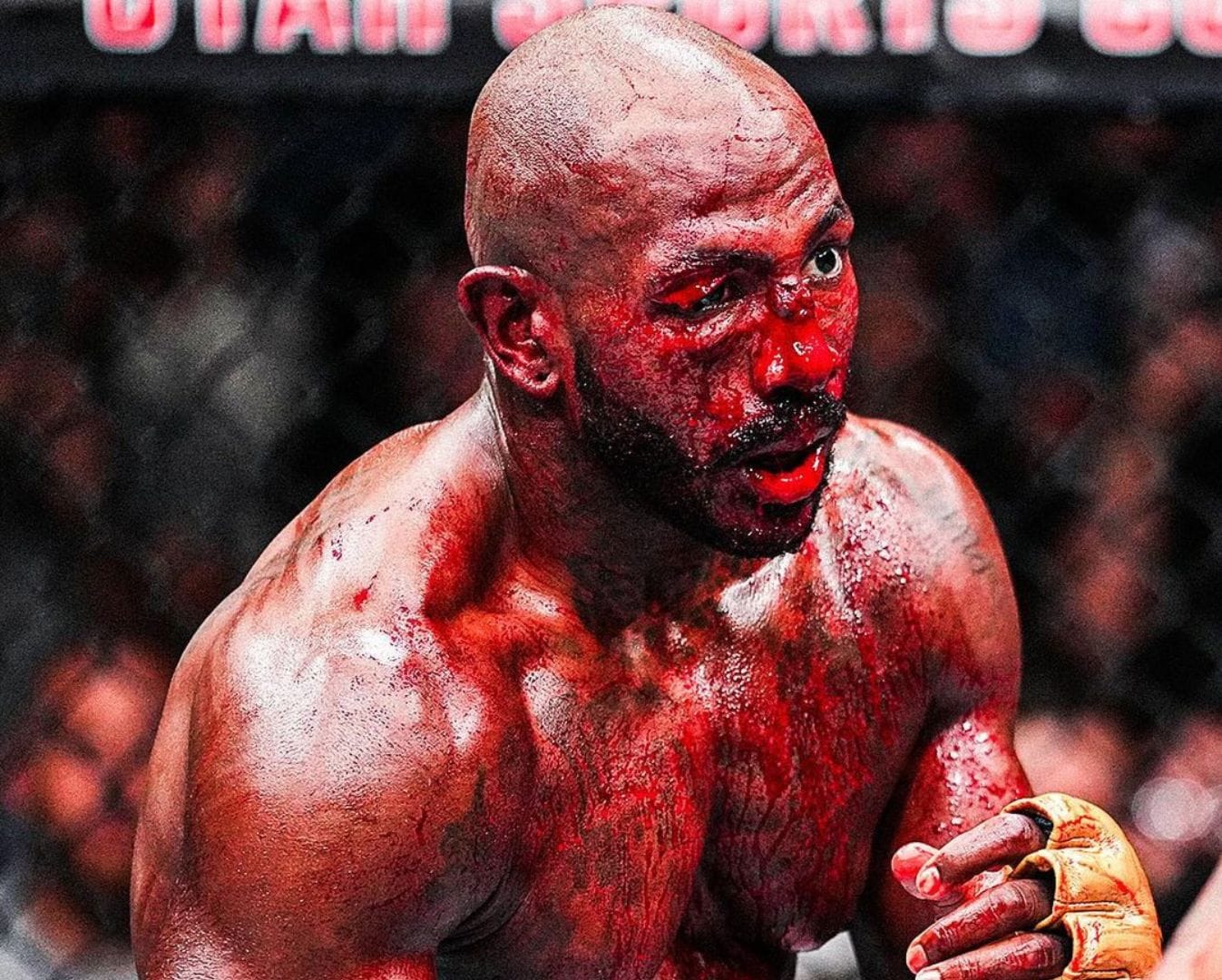 IMAGEM FORTE: Dana White Posta Foto De Rountree Desfigurado Após Luta ...